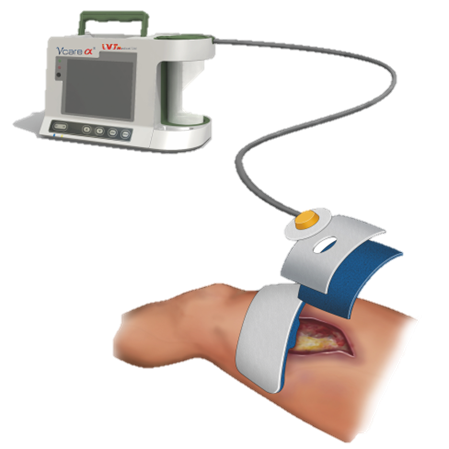 Vcare α® - Product Profile